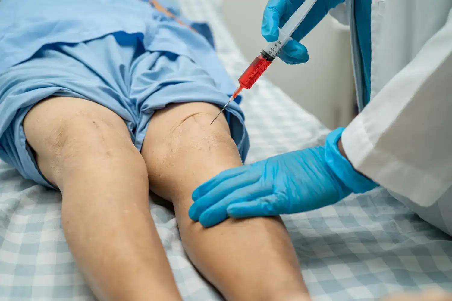 Durolane vs Monovisc - Which is the Better Joint Treatment? - Med Supply Solutions